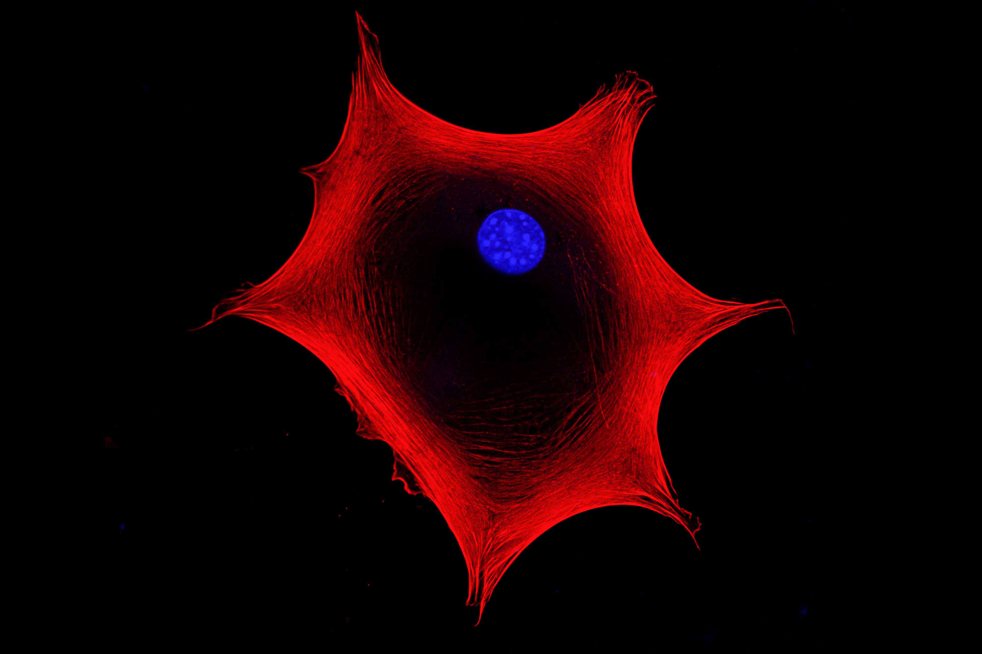 Mesenchymal Stem Cells (MSCs) | ANOVA IRM Germany